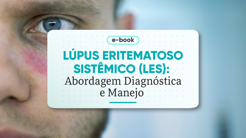 [ARTMED] E-book | Lúpus Eritematoso Sistêmico (LES)